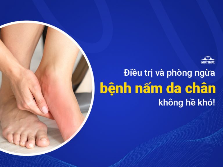Điều trị và phòng ngừa bệnh nấm da chân không hề khó - Bệnh học 4 phương